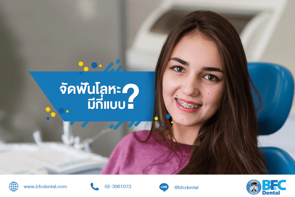 การจัดฟันโลหะ มีกี่แบบ? - BFC Dental