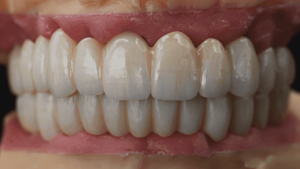 All-on-4 - BFC-Dental