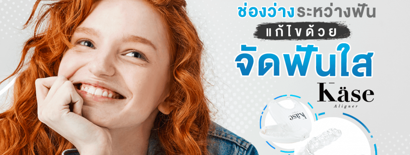 ช่องว่างระหว่างฟัน แก้ไขด้วยจัดฟันใส Käse Aligner - BFC Dental